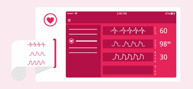 Como é feito o exame Holter e qual a sua importância?