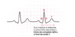 O que é o intervalo QT no eletrocardiograma? | Neomed