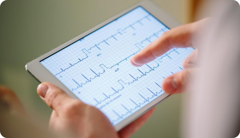 Como identificar fibrilação atrial no ECG? | Neomed