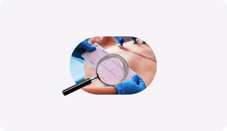 Onda P: qual o seu significado no eletrocardiograma? | Neomed
