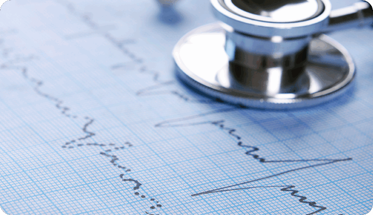 Segmento ST: entenda sua importância no eletrocardiograma | Neomed